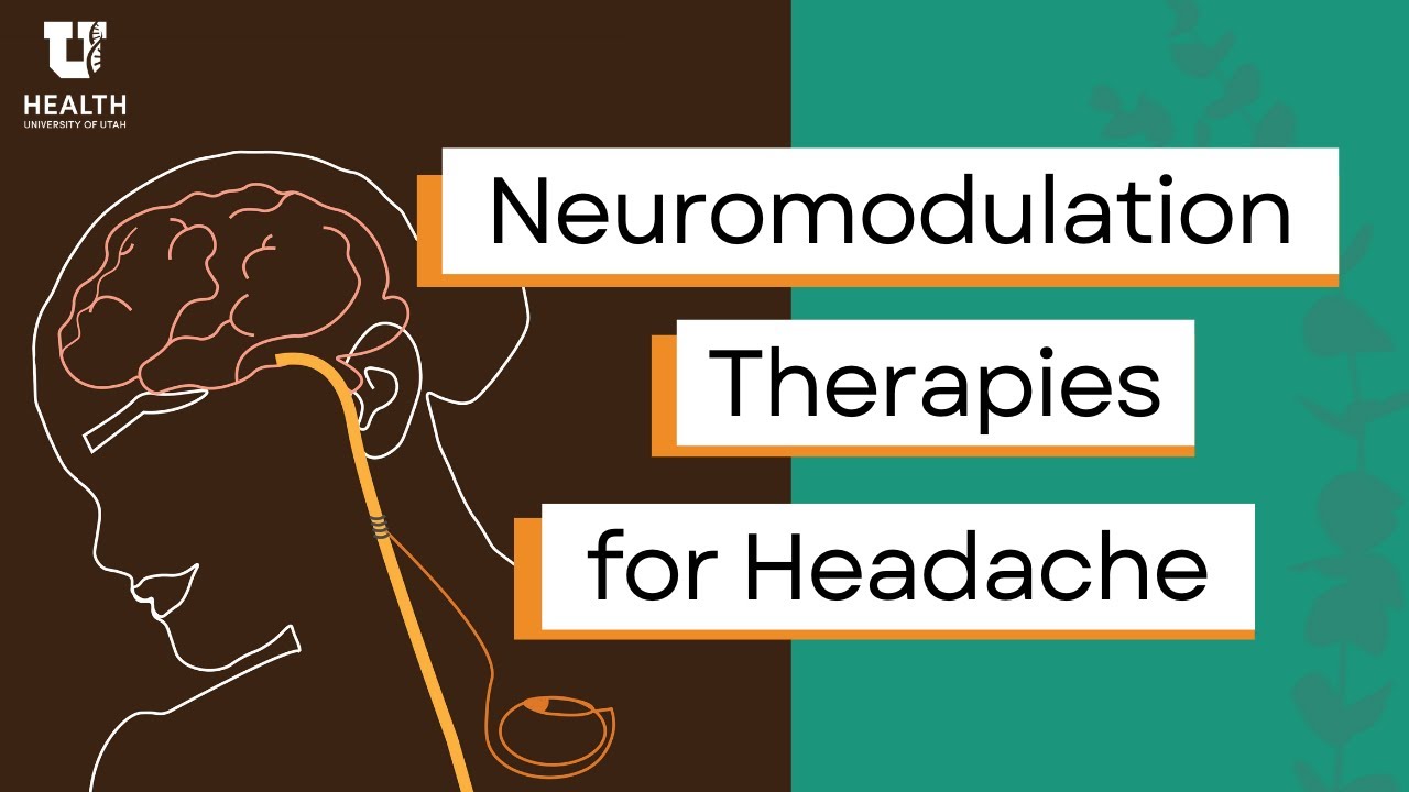 Neuromodulation Therapies for Headache - YouTube