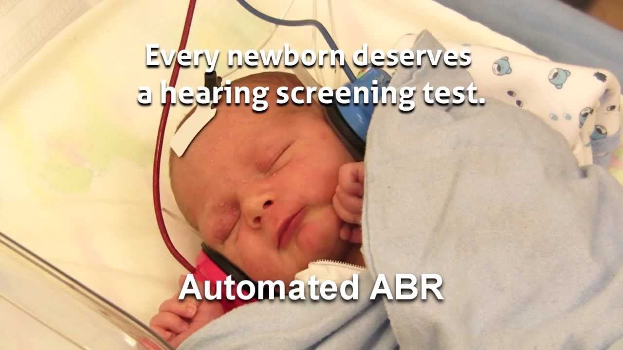 Newborn Hearing Screening System By Vivosonic YouTube newborn-hearing-screening-system-by-vivosonic-youtube