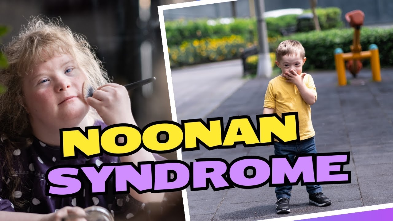 What is Noonan Syndrome ? Symptoms, Treatment, Causes, Prognosis - YouTube