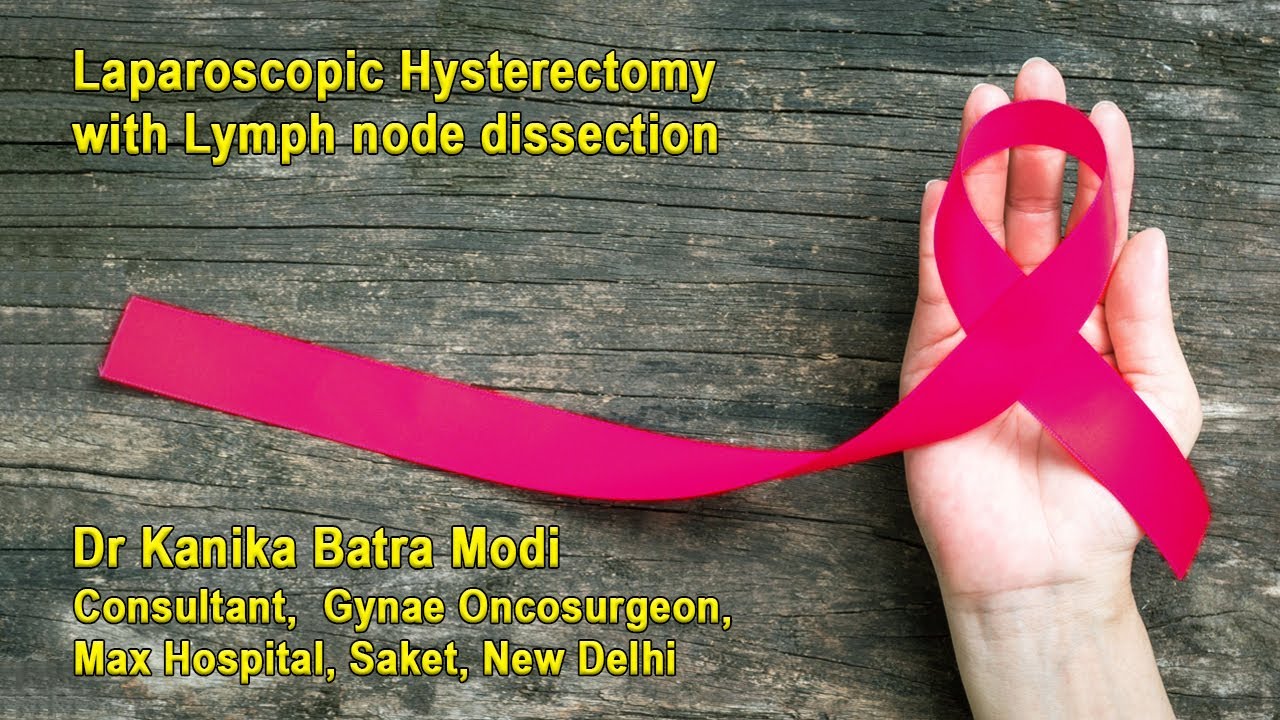 Laparoscopic Hysterectomy with Para Aortic Lymph node dissection by Dr ...