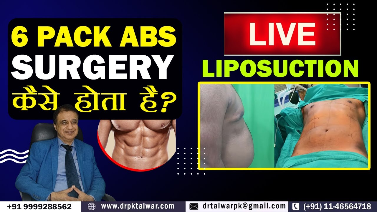 How to Make 6 Pack Abs with Liposuction Surgery, Liposuction Surgery in ...