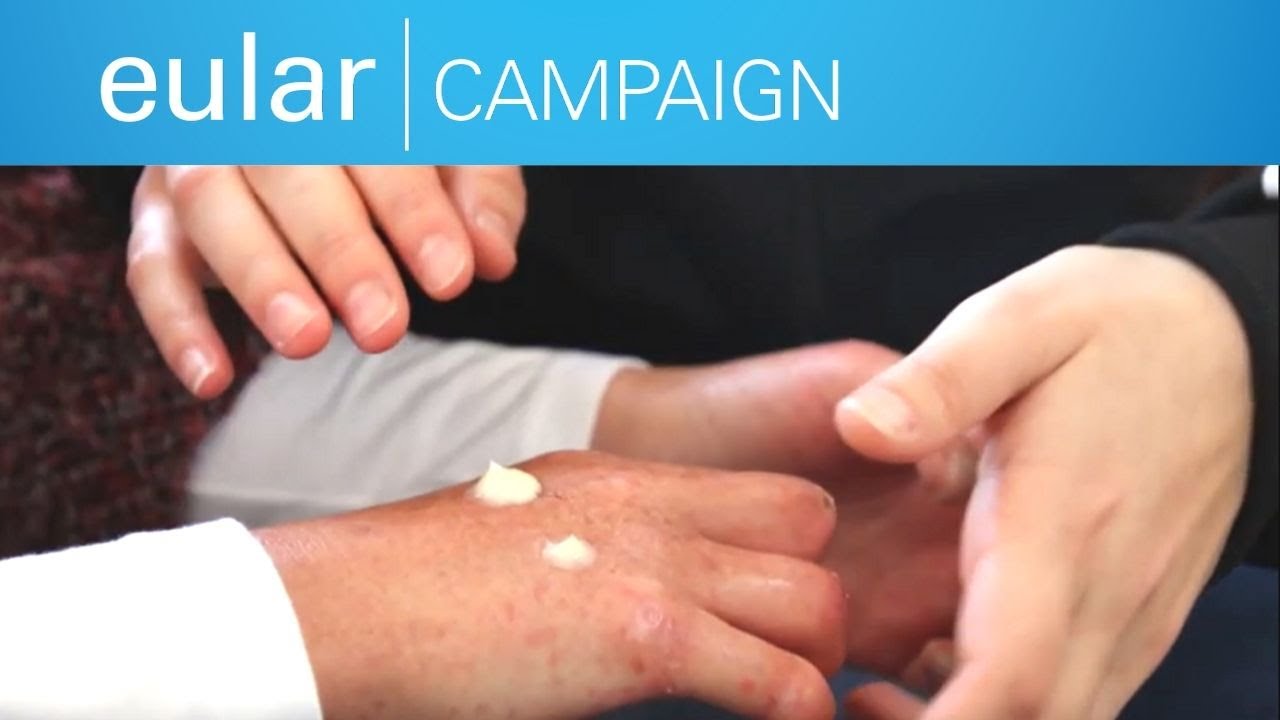 World Arthritis Day 2019: EULAR Campaign Time2Work, A Day in the Life in Cyprus - YouTube