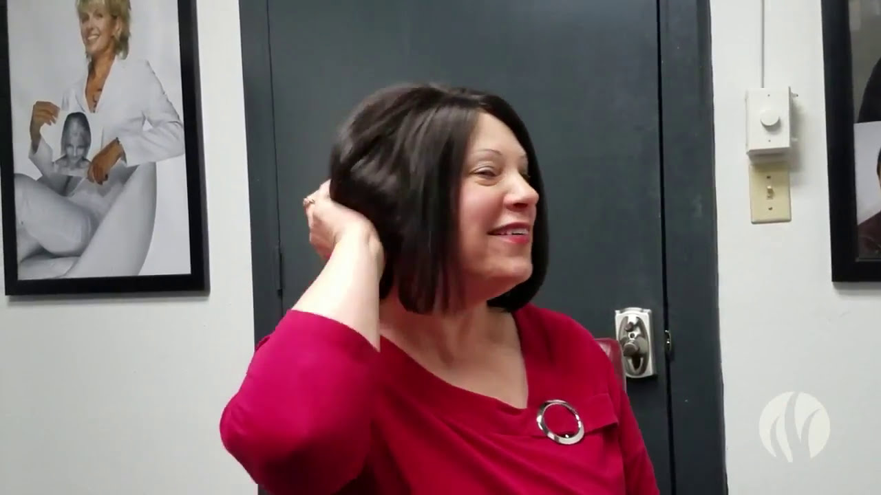 Debby's Testimonial | Coping with Trichotillomania | HRI Dermal Lens ...