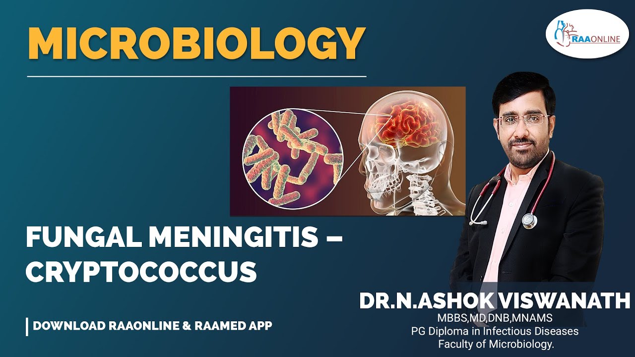 Microbiology | Fungal Meningitis - Cryptococcus | Raaonline #microbiology #fungal #cryptococcus ...