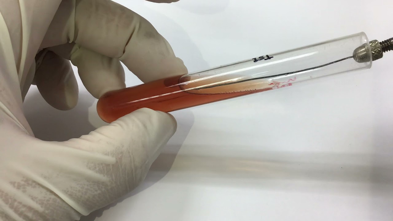 TSI inoculation - YouTube