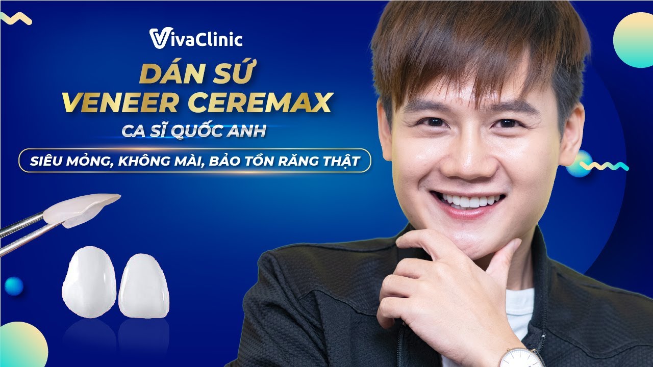 Dán sứ Veneer Ceremax siêu mỏng KHÔNG mài răng I Nha Khoa Quốc Tế Viva ...
