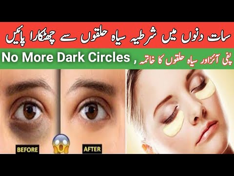 How to Remove Dark Circle/Get Rid of Dark Circles Naturally in 7 Days ...