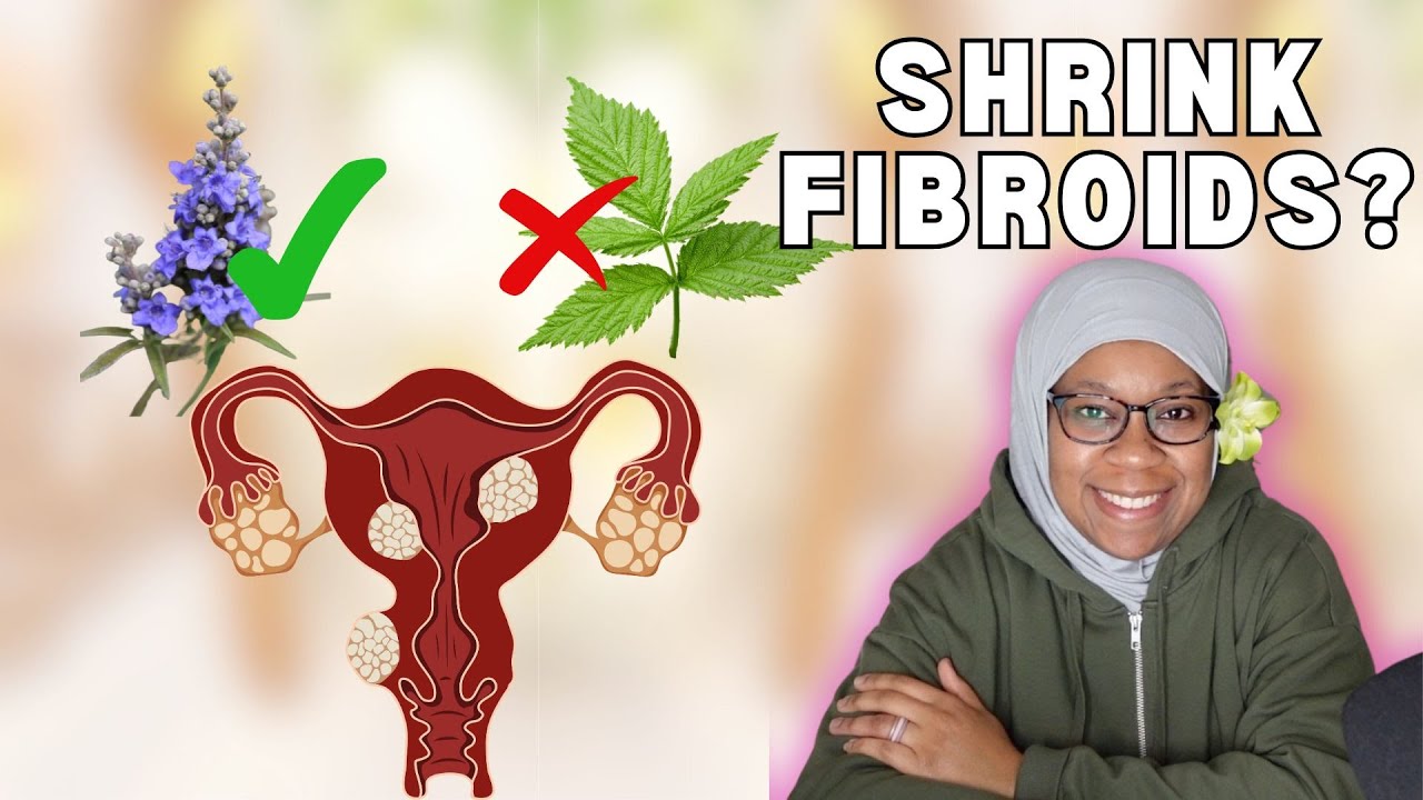 Shrink Fibroids with these 4 Herbs and Supplements - YouTube