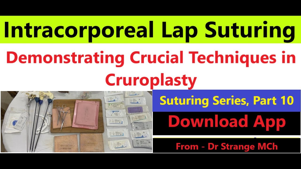 Intracorporeal Suturing: Demonstrating Crucial Techniques in ...