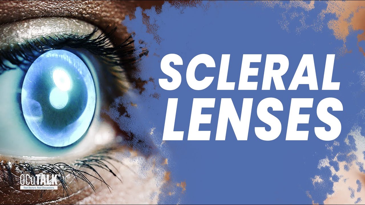 What are scleral lenses? Dr. Morrison explains - YouTube