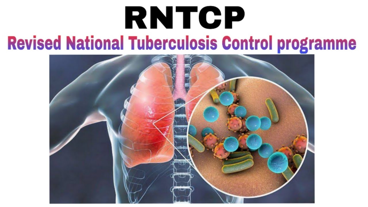 RNTCP ( Revised National Tuberculosis Control programme) / Community ...