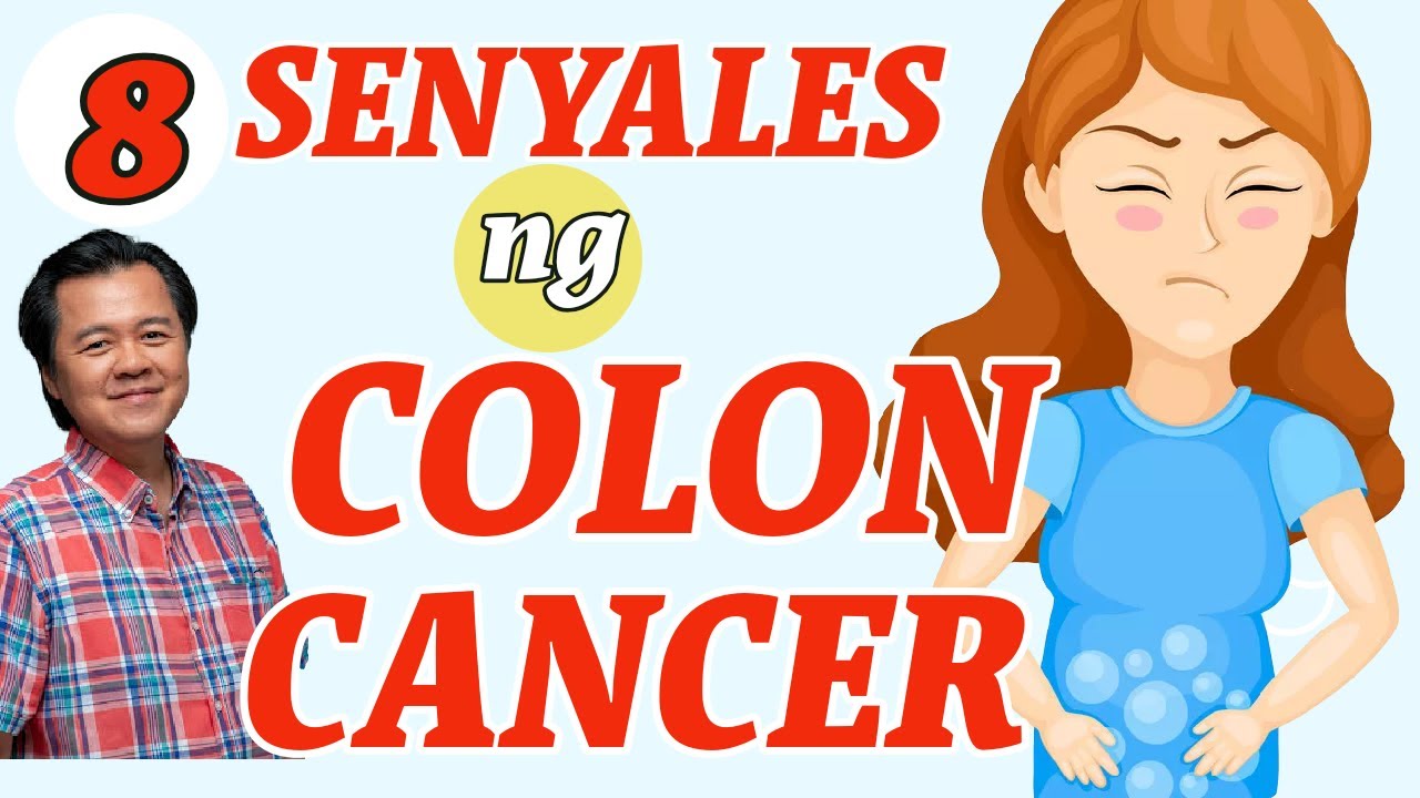 8 Senyales ng Colon Cancer - By Doc Willie Ong - YouTube