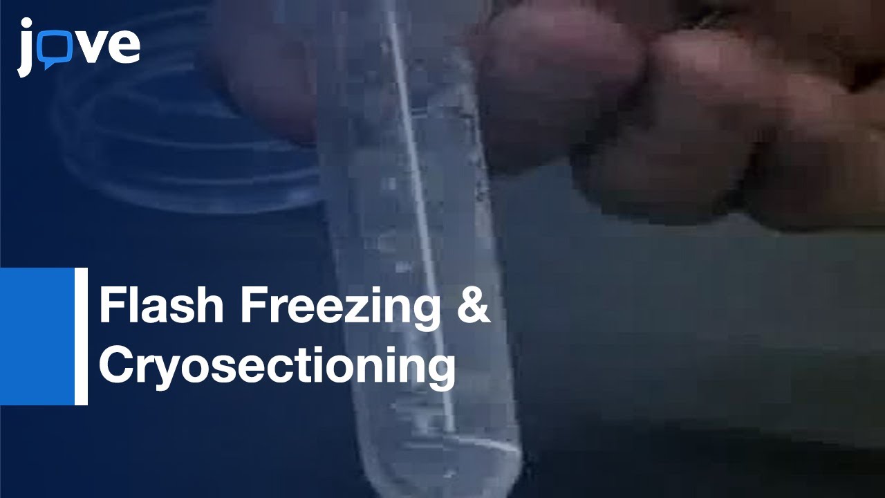 Flash Freezing & Cryosectioning E12.5 Mouse Brain l Protocol Preview ...