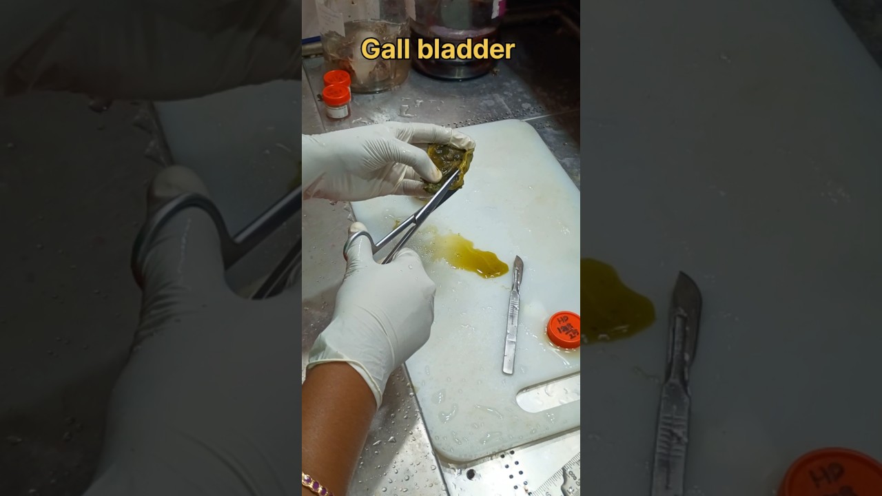 Gall bladder specimen 🧐| #histopathology #histomuseum # ...