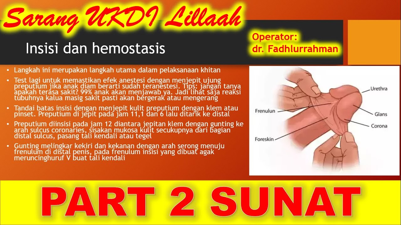 PART 2 AYO SUNAT KHITAN SIRKUMSISI - YouTube