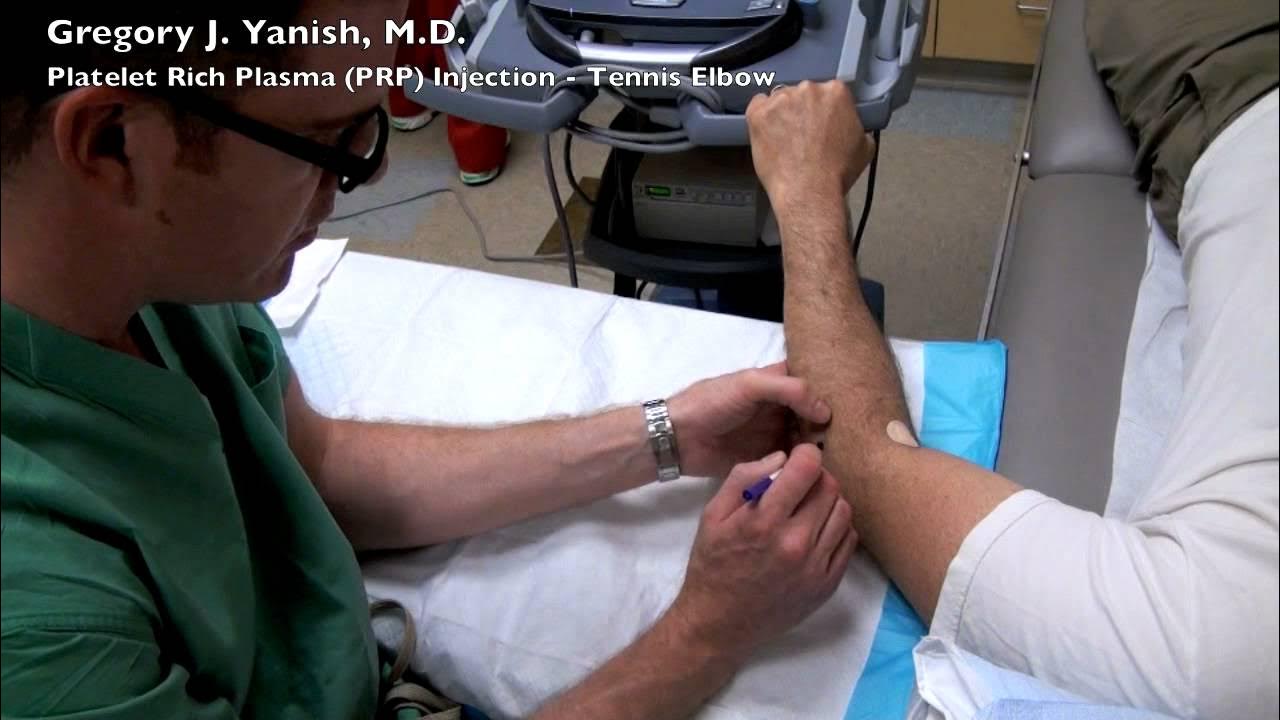 Platelet Rich Plasma (PRP) Injection Ultrasound Guided for Tennis Elbow - YouTube