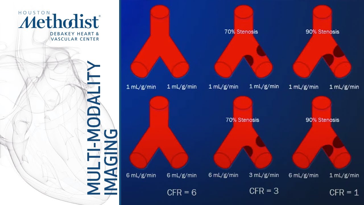 Stress CMR: Methodology, Current Role, and Case Studies (Eric Y. Yang ...