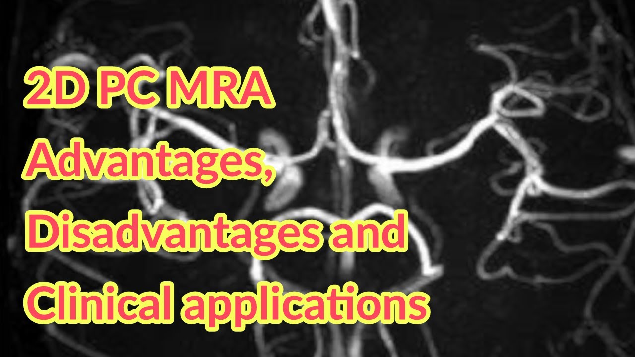 2D Phase contrast MRA Advantages Disadvantages and clinical ...