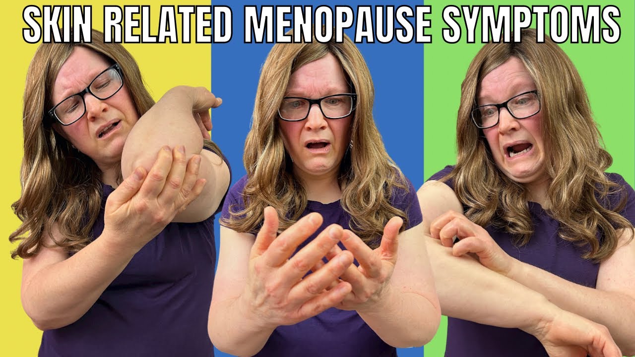 Hypersensitive skin in menopause. 4 Skin related menopause symptoms ...