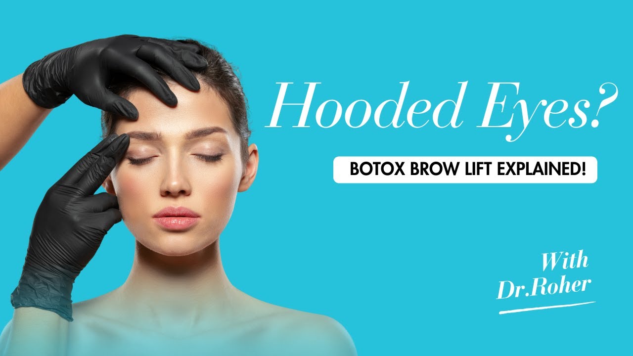 Understanding Hooded Eye Botox Brow Lift - YouTube