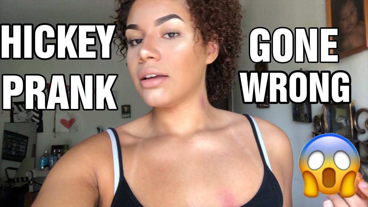 Hickey Prank On Dad Gone Wrong Youtube
