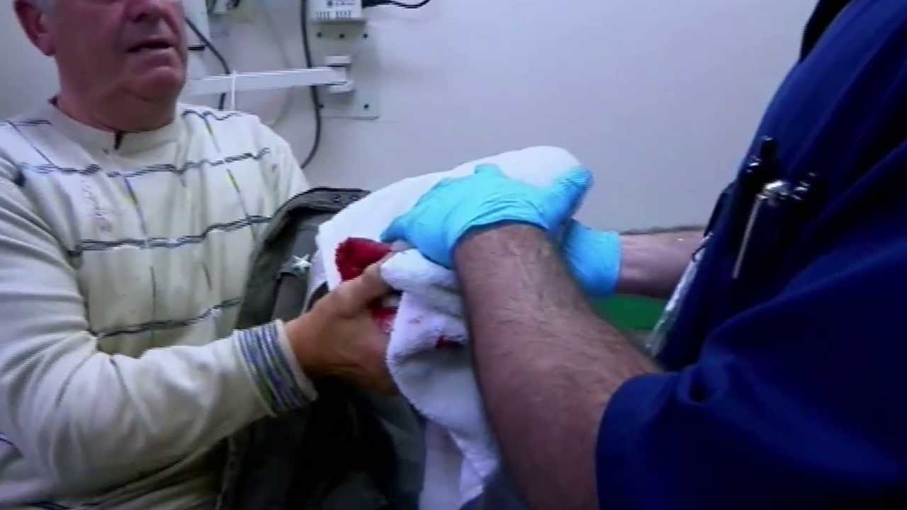 Hand Left In Shreds - Bizarre ER - YouTube