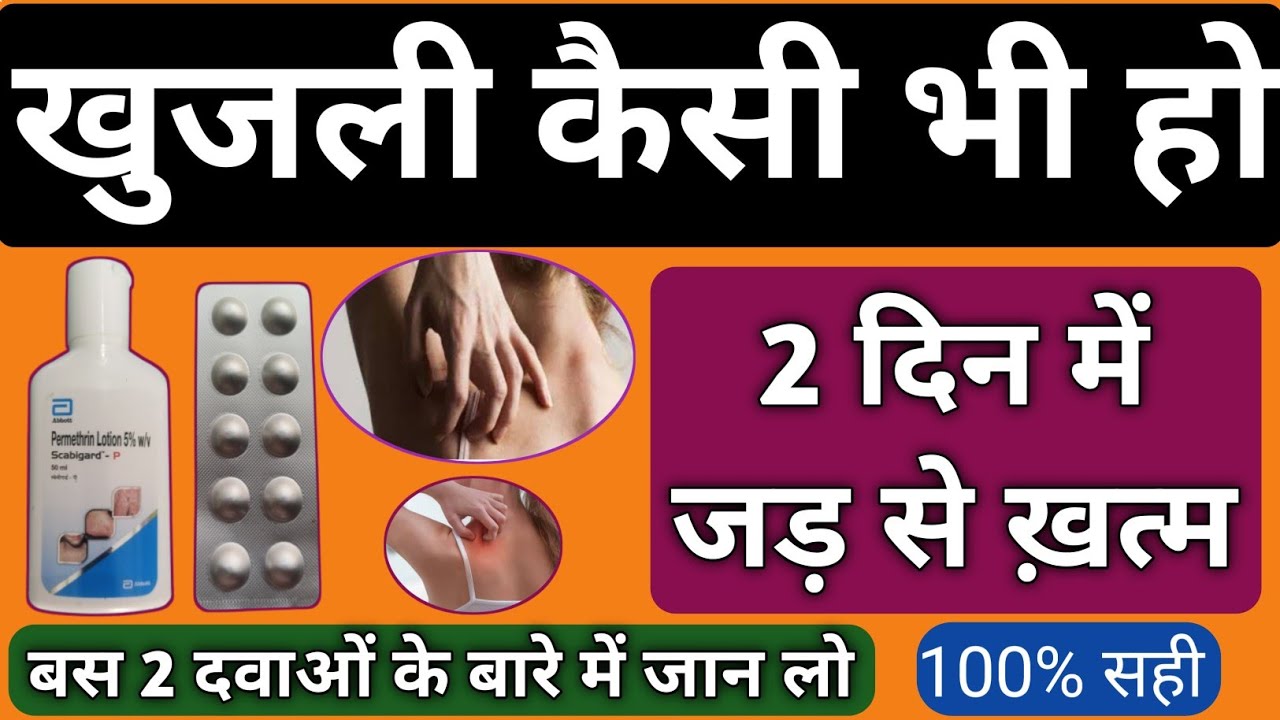 khujli ki dawa || khujli kaise dur kare || खुजली होगी जड़ से ख़त्म ...