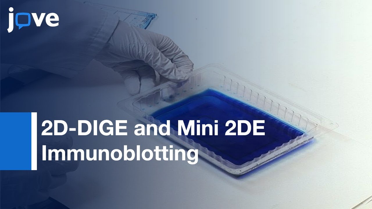 Brain Proteome Study by 2D-DIGE and Mini 2DE Immunoblotting | Protocol ...