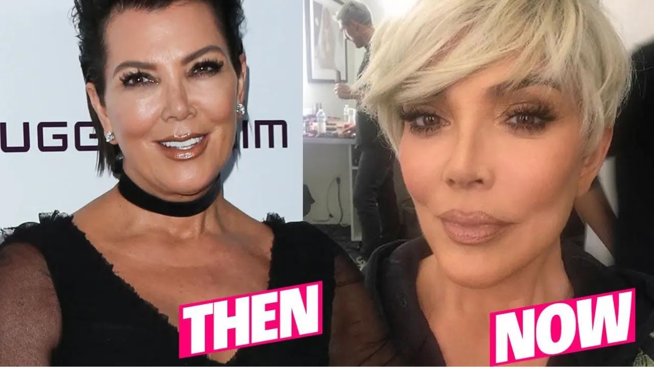 Kris Jenner SHOCKS Fans with "Insane Cheek Implants" in New Video - YouTube
