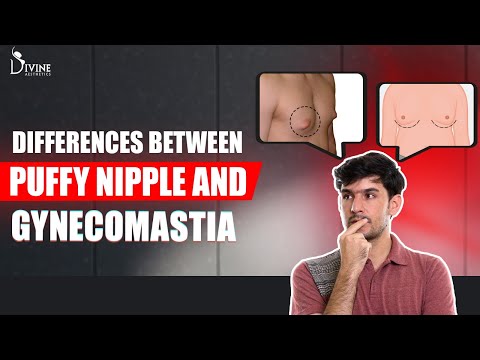 Puffy Nipples vs. Gynecomastia: Key Differences and Treatment Options