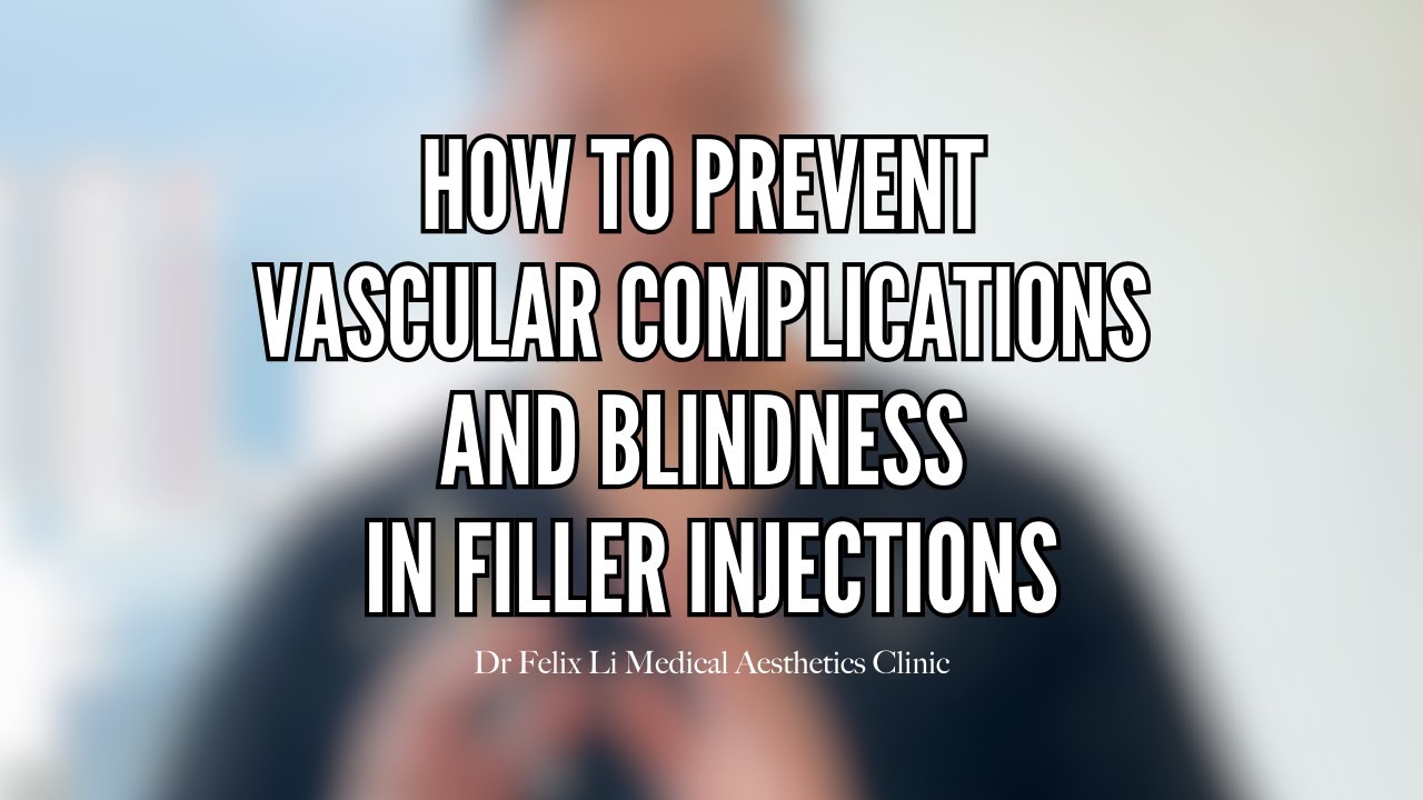 How to PREVENT VASCULAR COMPLICATIONS AND BLINDNESS in filler ...