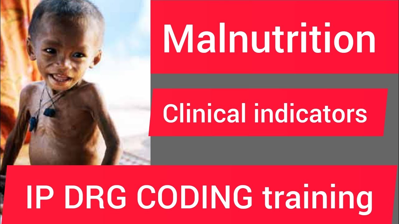IP DRG Coding| Clinical Indicators|Malnutrition - YouTube