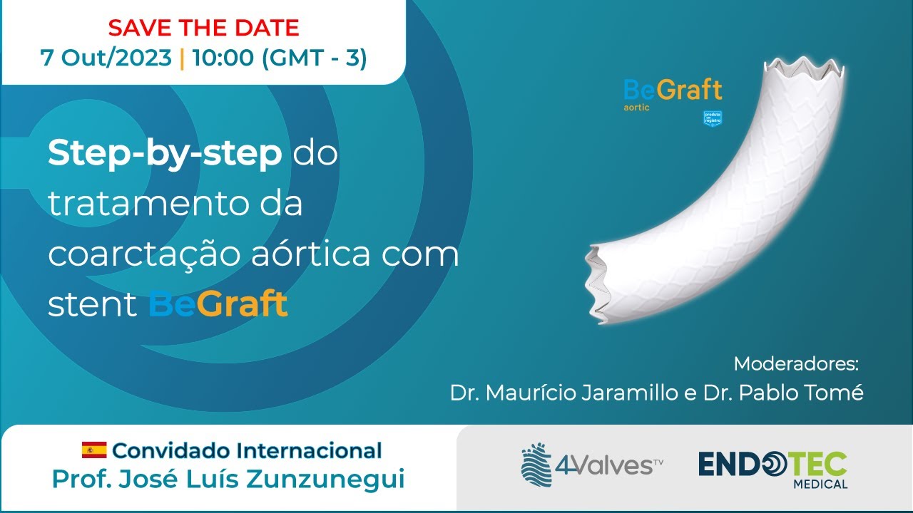 Step-by-step do tratamento da coarctação aórtica com stent BeGraft ...