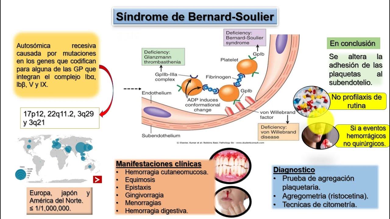 Síndrome de Bernard - Soulier | Trastornos de la hemostasia 💉🩸🔬 - YouTube