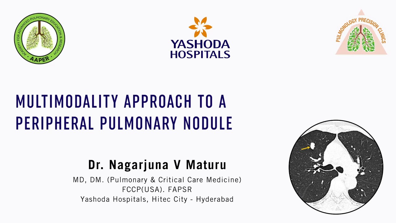 Multimodality Approach to a Peripheral Pulmonary Nodule: The Five Step ...