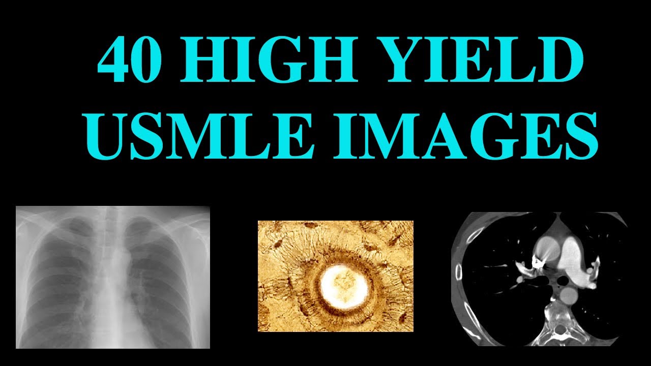 40 High Yield Images for USMLE (CT, XRay, Histology) - YouTube