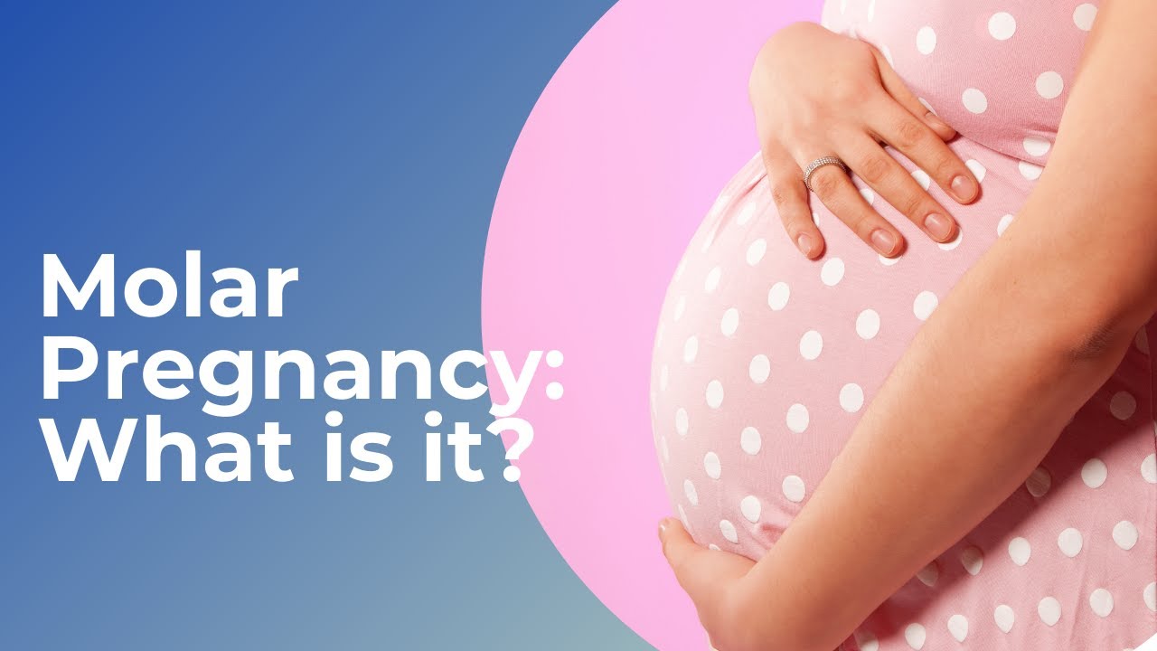 Everything You Should Know About Molar Pregnancy - YouTube