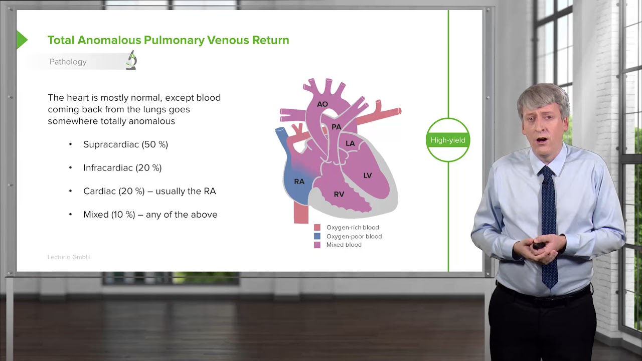 5 Total Anomalous Pulmonary Venous Return TAPVR - YouTube