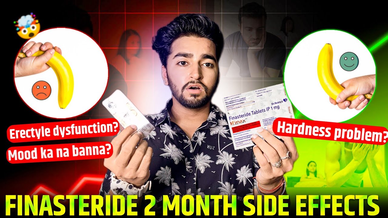 Finasteride 2 Month Side Effects Genuine Video - YouTube