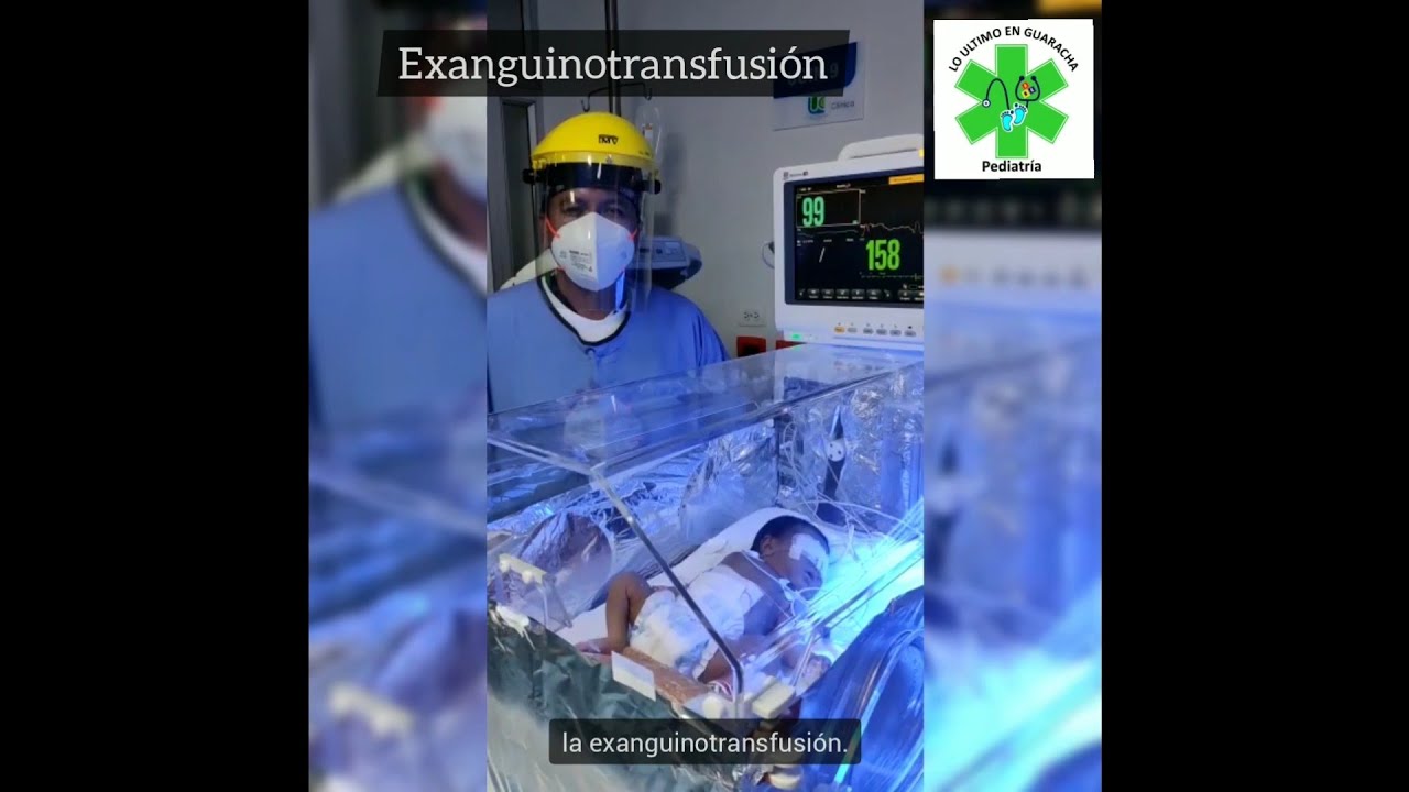 Exanguinotransfusión. - YouTube