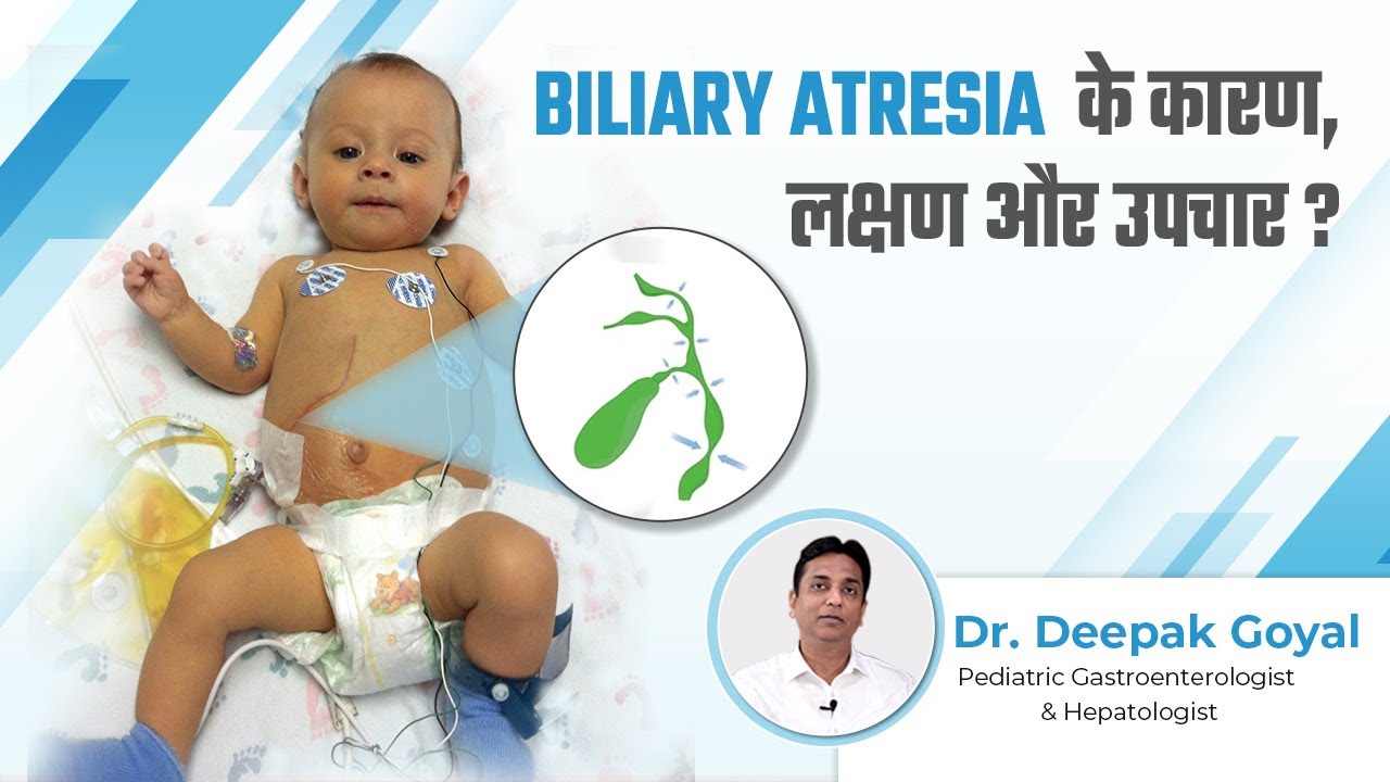 Biliary Atresia के कारण, लक्षण और उपचार? | Biliary Atresia Baby | Dr ...