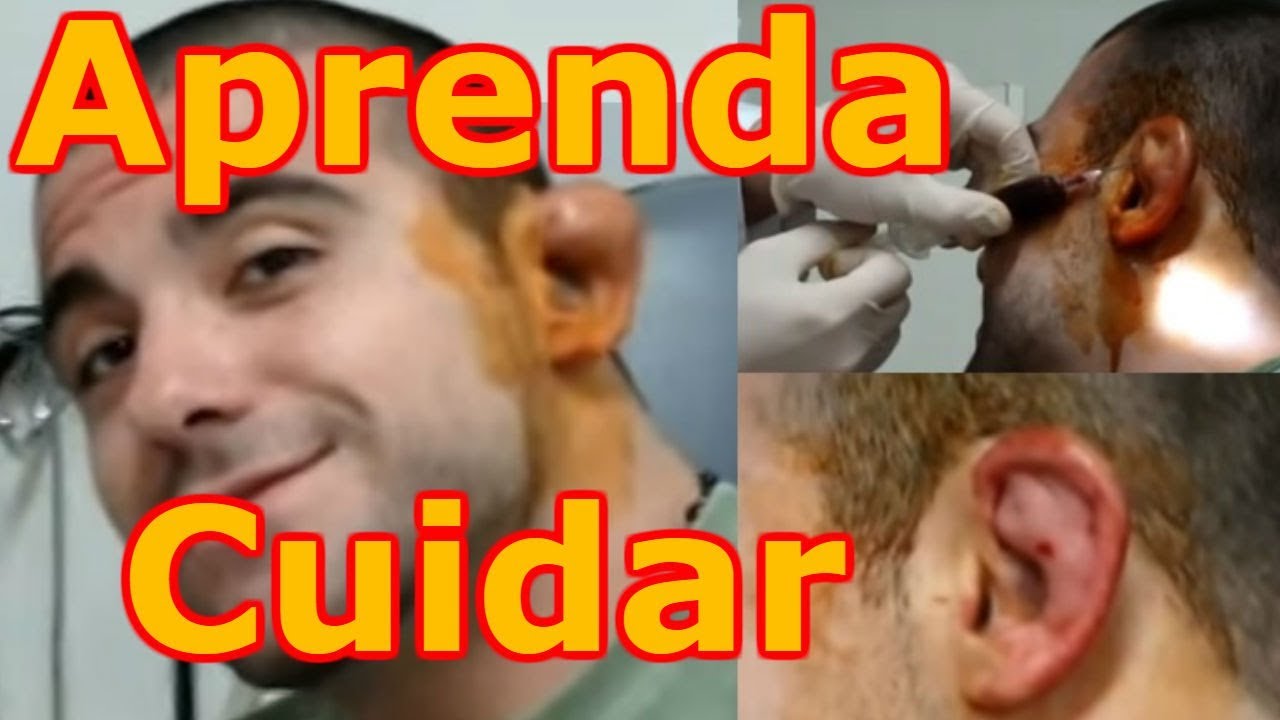 Orelha de Cove Flor Como Cuidar - YouTube