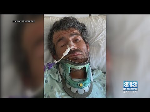 CHP Seeks To Identify Mystery Man With Amnesia In Sacramento