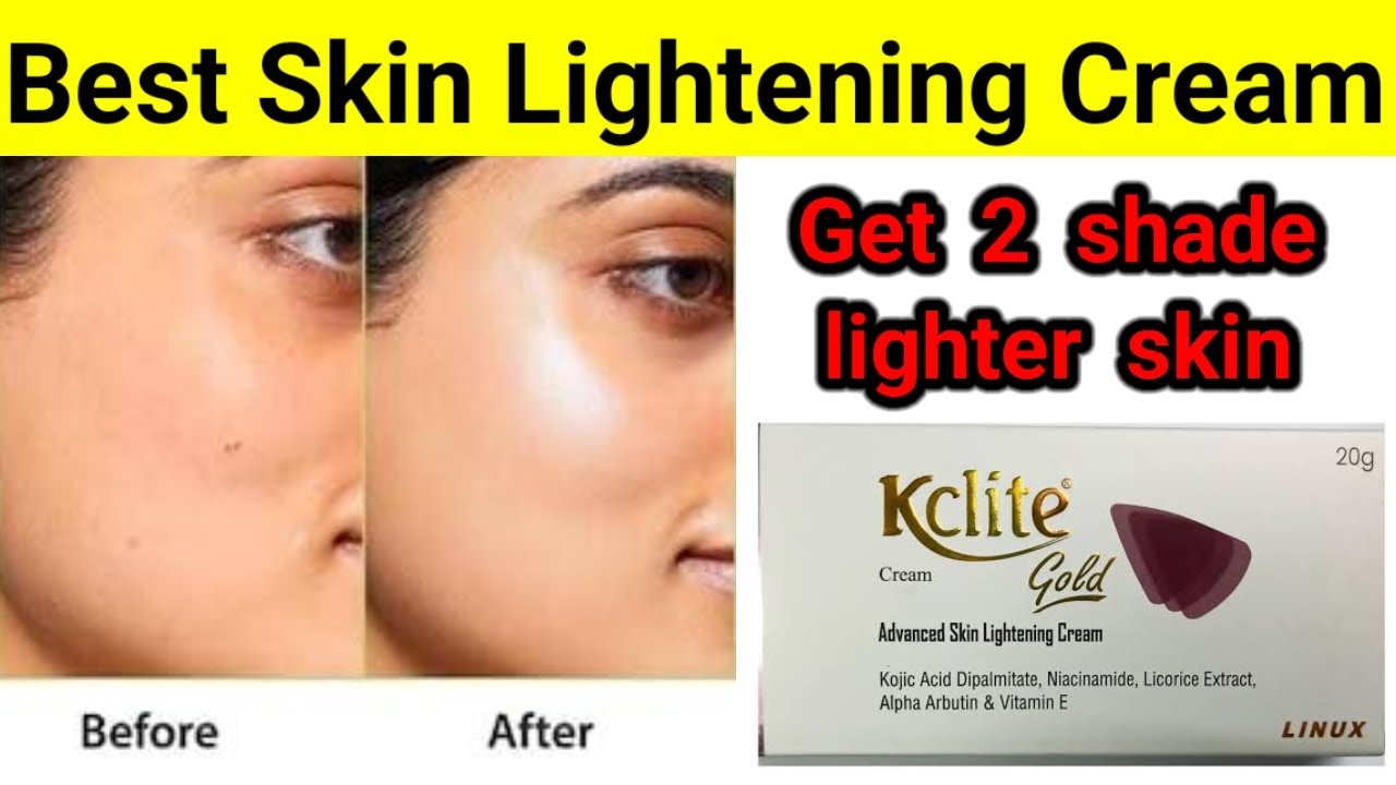 दाग धब्बे को मिटाकर चेहरे को 2 shade साफ करता है| Best skin lightening ...