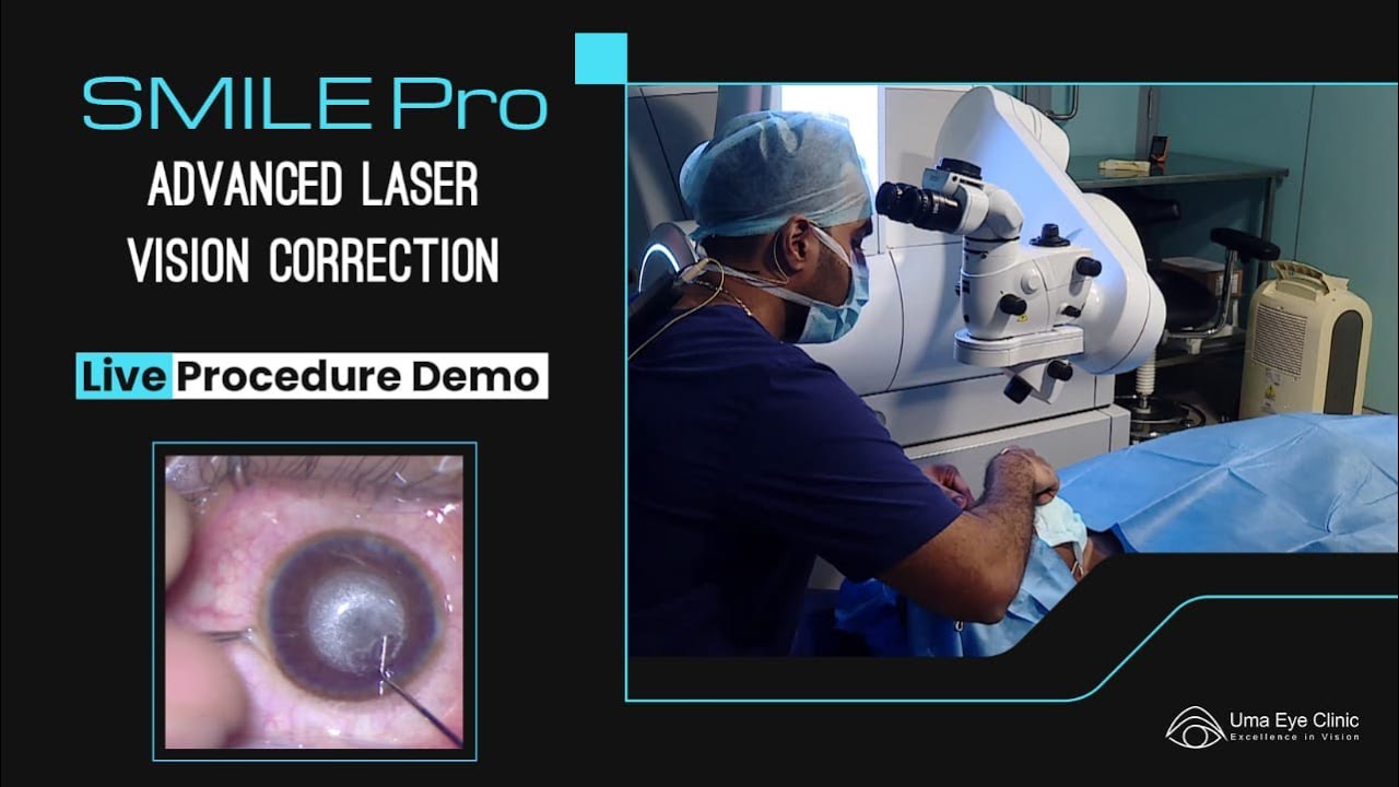 SMILE Pro Live procedure demonstration | Madras City Ophthalmic ...