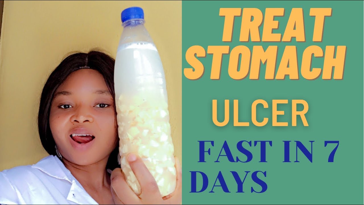 How To Treat Stomach Ulcer Best Home Remedy To Cure Ulcer Chi s how-to-treat-stomach-ulcer-best-home-remedy-to-cure-ulcer-chi-s