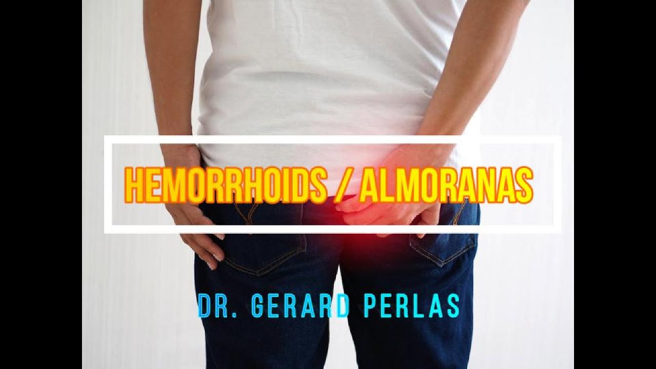Hemorrhoids "Almoranas" Mga dapat gawin. - YouTube
