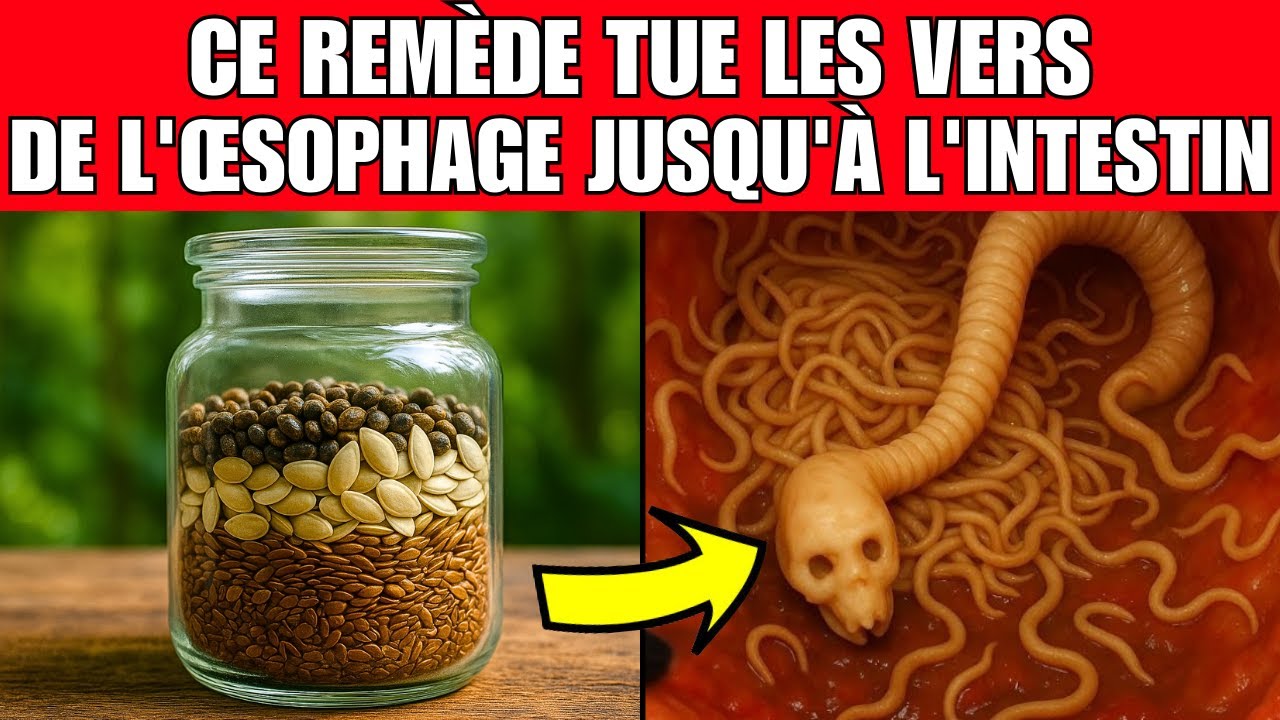 ÉLIMINEZ les VERS - 5 remèdes naturels qui détruisent les parasites ...