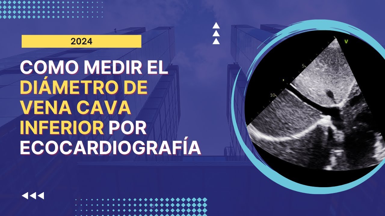 🧐[Cómo Medir] el 🎯DIÁMETRO DE LA VENA CAVA INFERIOR por Ecocardiografía: Paso a paso - YouTube