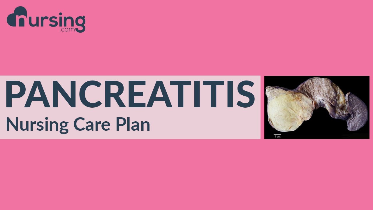 Nursing Care Plan For Pancreatitis Nursing Care Plan Tutorial YouTube nursing-care-plan-for-pancreatitis-nursing-care-plan-tutorial-youtube